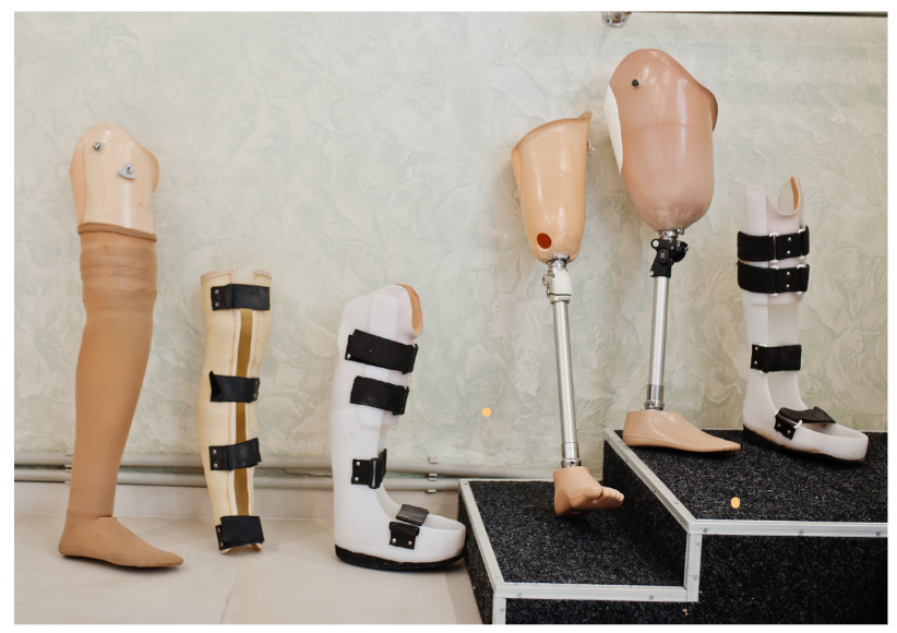Orthotics vs. Prosthetics: What’s the Difference? - Alliance ...